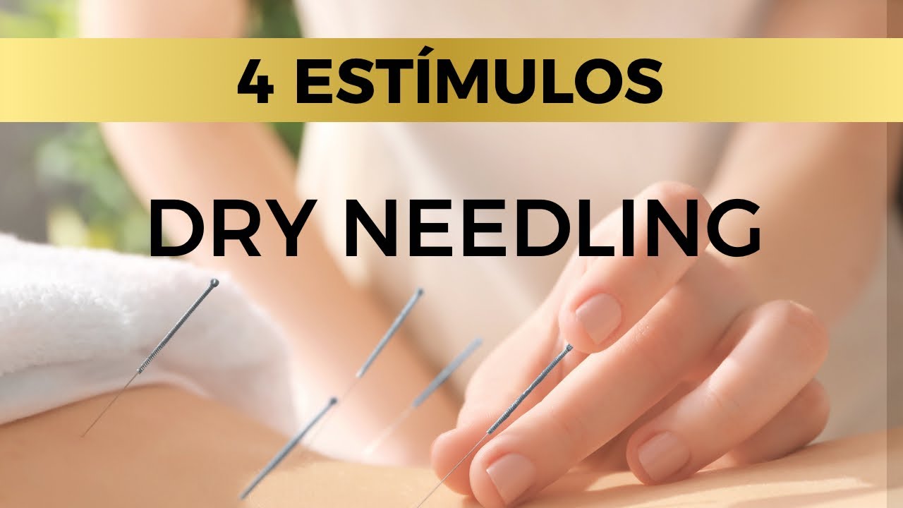 Dry Needling - aprenda os 4 estímulos da técnica para dor miofascial ...