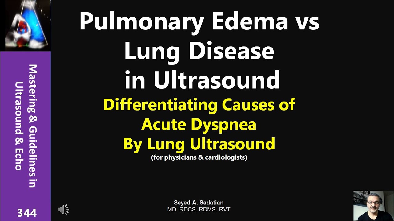 Pulmonary Edema vs Lung Disease in US: Differentiating Causes of Acute ...