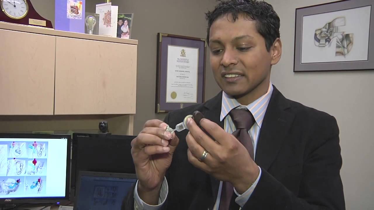 BONEBRIDGE bone conduction implant - YouTube