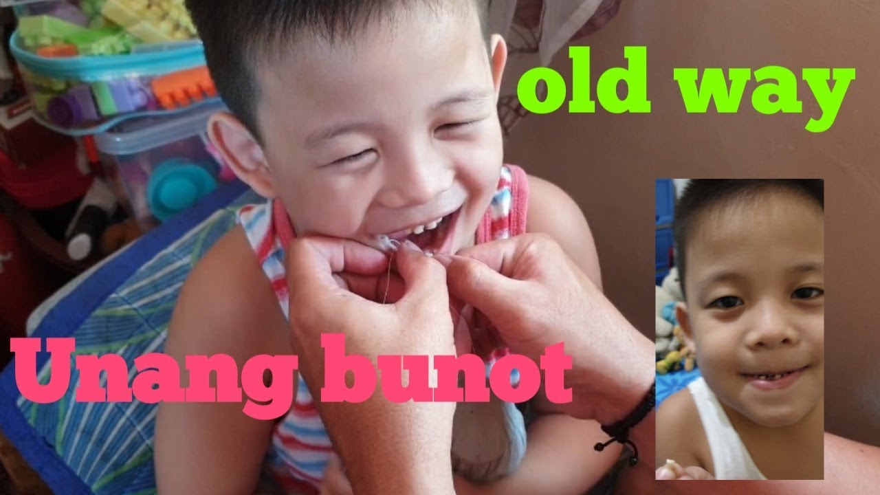 First Tooth Extraction - YouTube