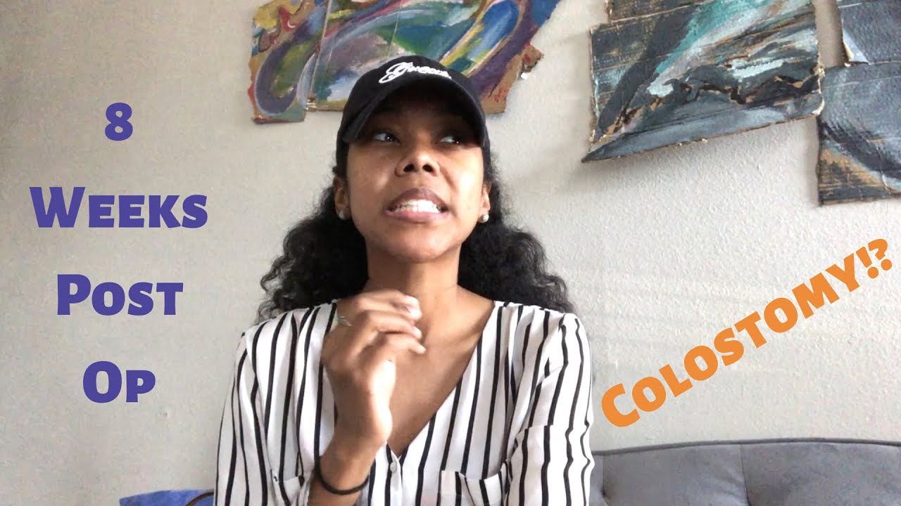 Colostomy - 8 week post op - YouTube