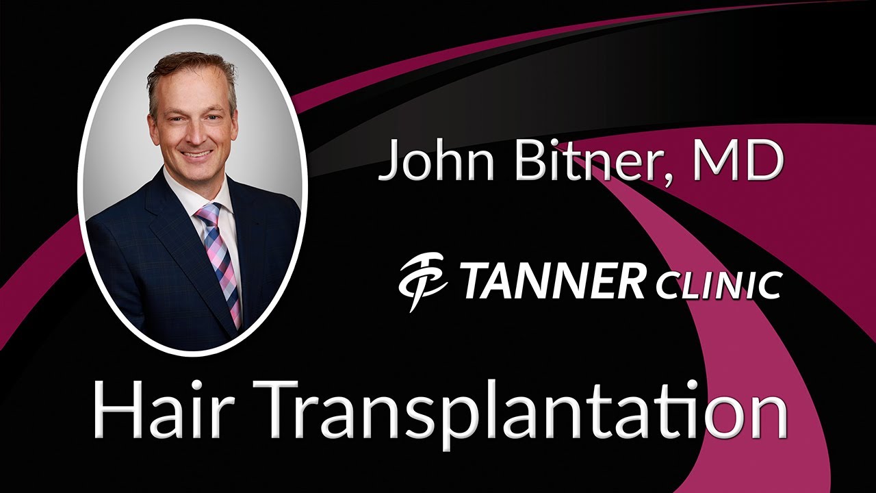 Hair Transplantation with Dr. John Bitner at Tanner Clinic in Layton ...