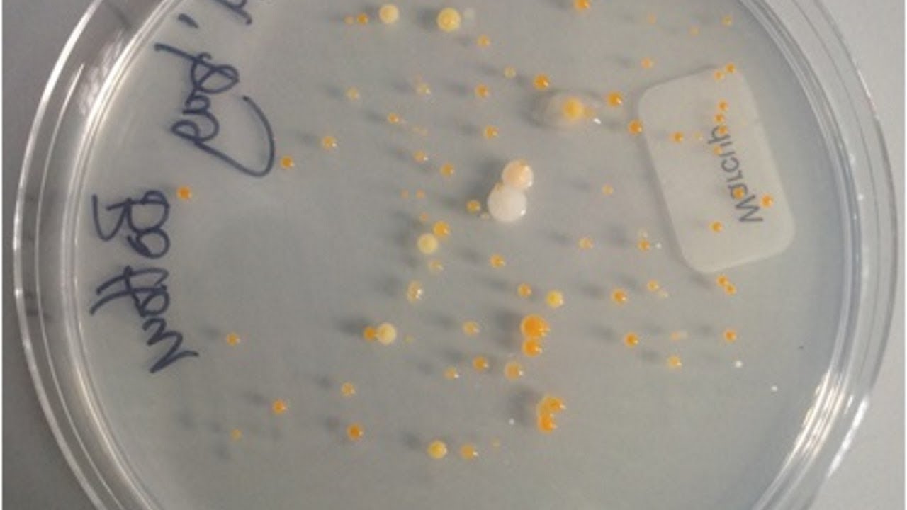 Viable Counts: Calculation - YouTube