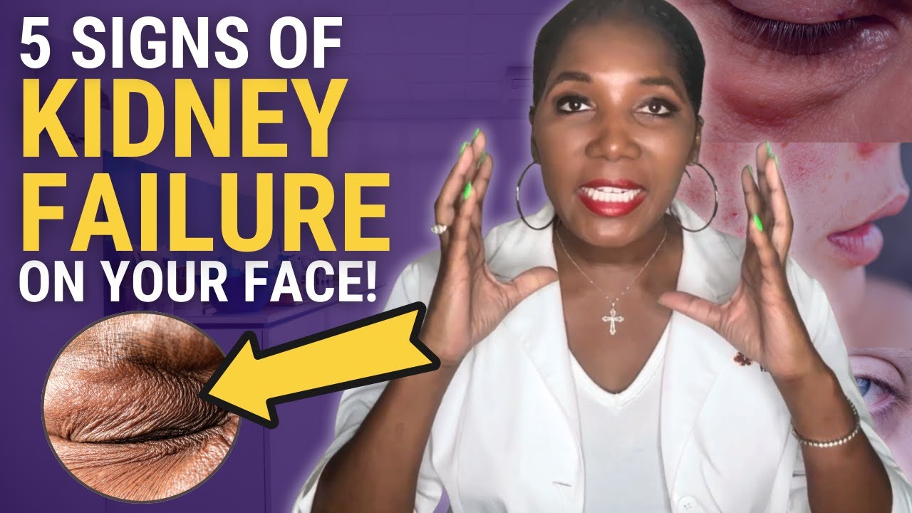 5 Early Warning Signs Of Kidney Disease On Your Face