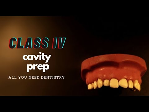 class 4 cavity preparation on tooth#21 - YouTube
