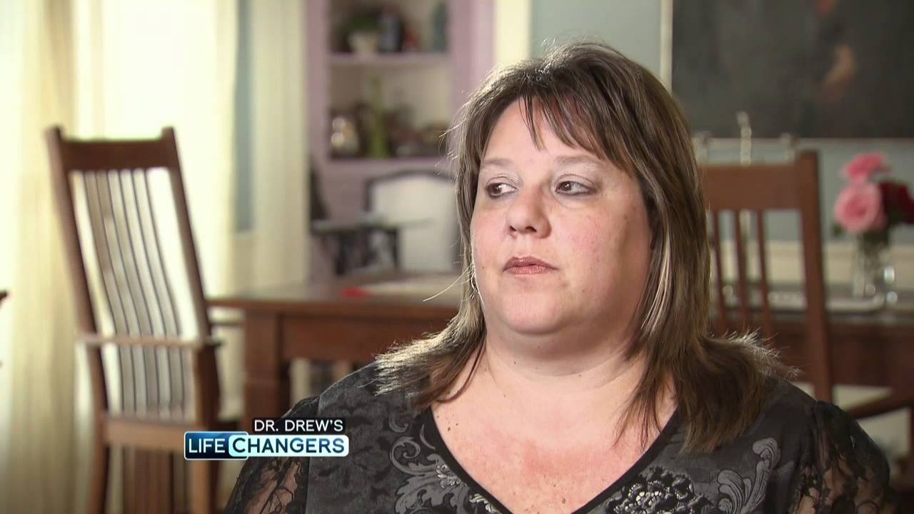 A Burn Survivor's Tragic Story - YouTube