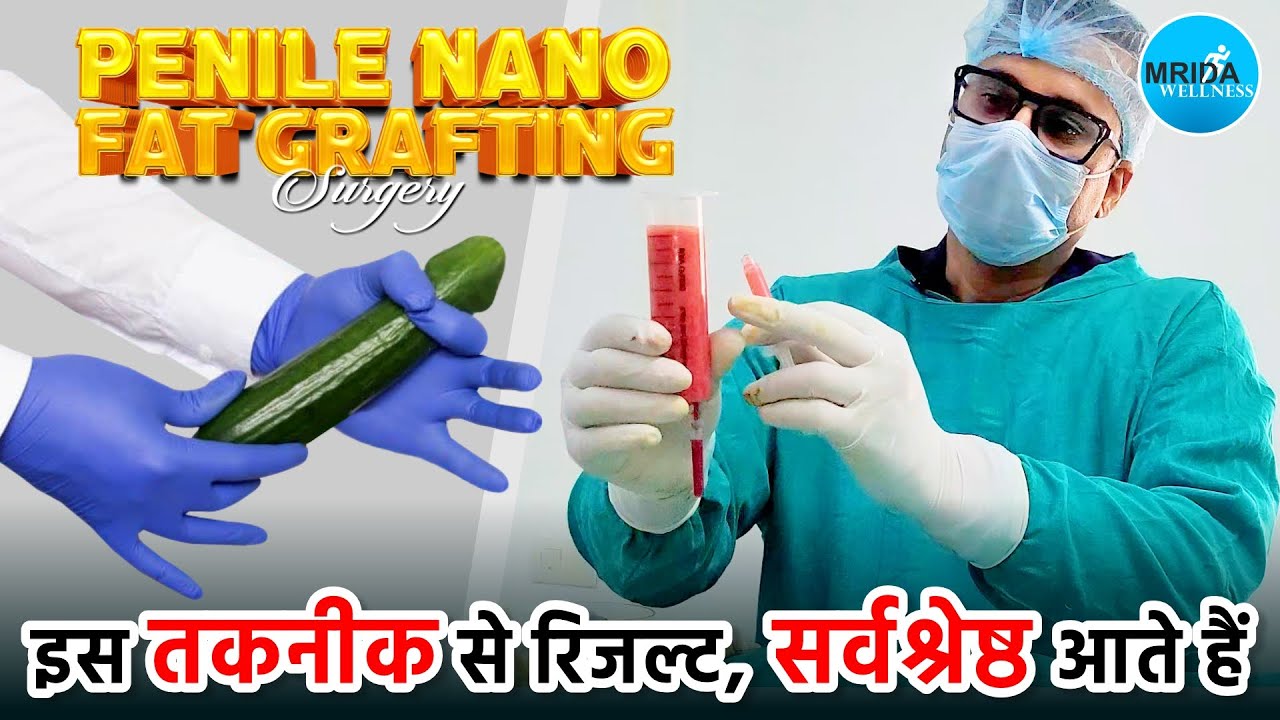 Penile Nano Fat Grafting: Achieve Enhanced Girth with Natural Results ...