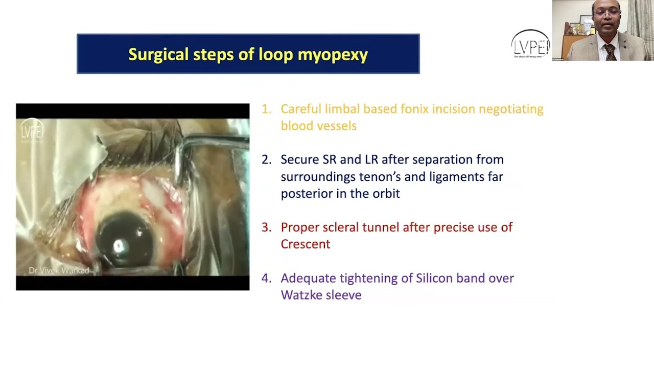 Lecture: The Surgical Management of Myopic Strabismus Fixus - YouTube