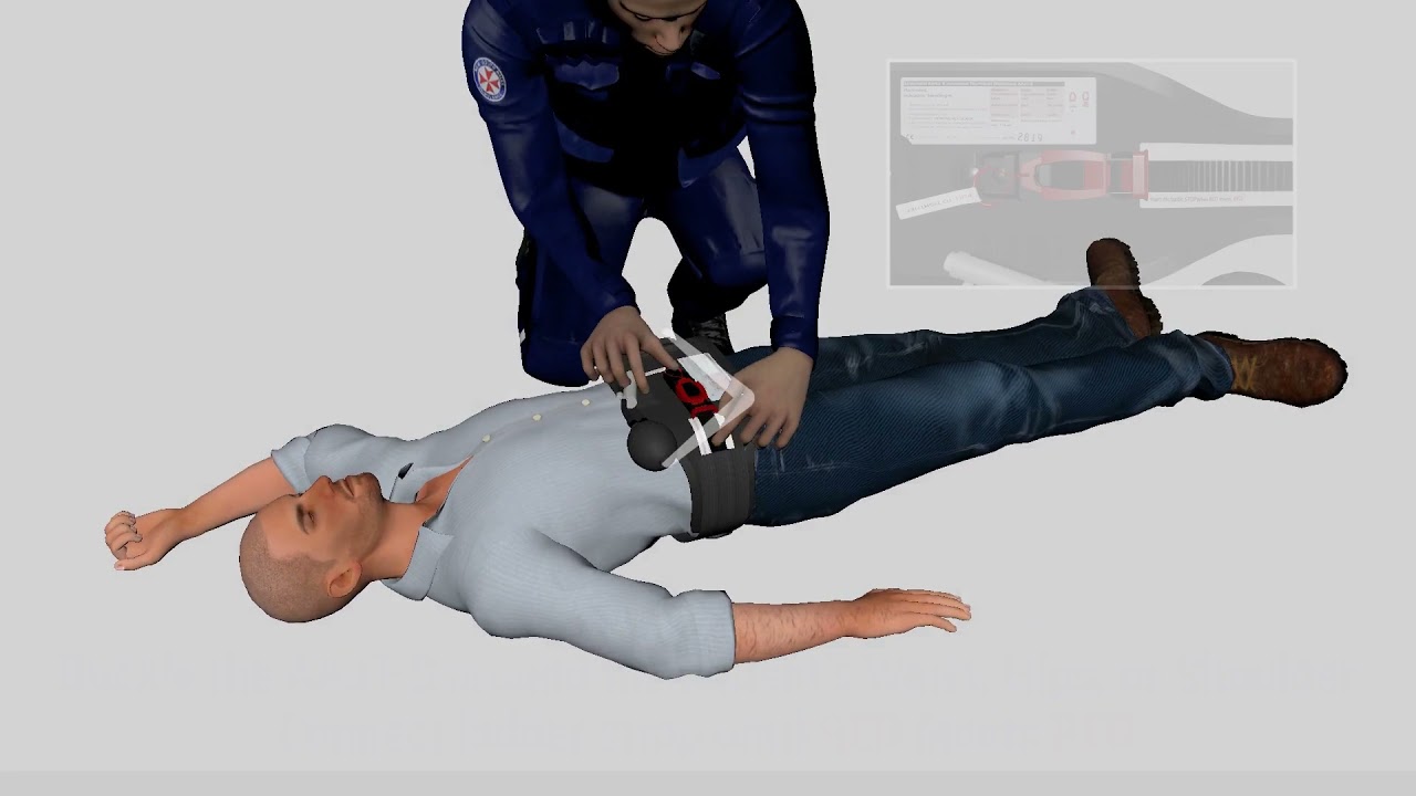 Abdominal Aortic and Junctional Tourniquet-Stabilized (AAJT-S)medical ...