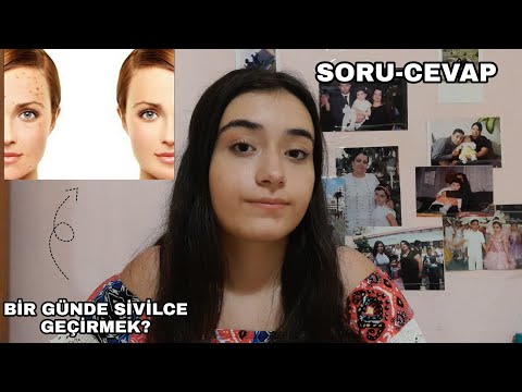 SİVİLCELERİ 1 GÜNDE GEÇİREN TARİİİF!!||Soru-Cevap