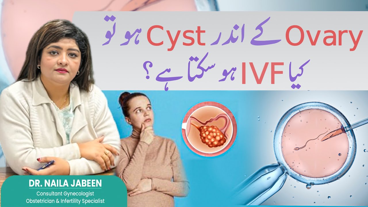 Ovarian Cysts & IVF: Can You Still Do It? | Everything to Know from a ...