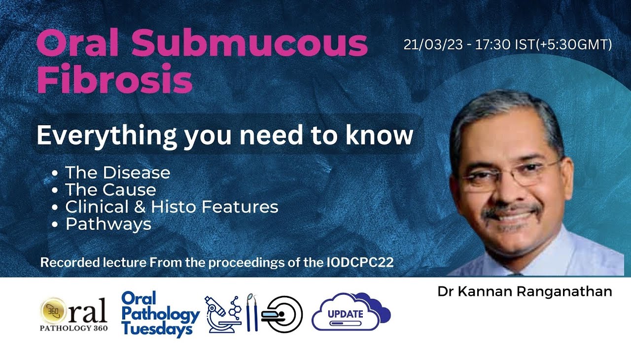 Oral Submucous Fibrosis- A primer - YouTube