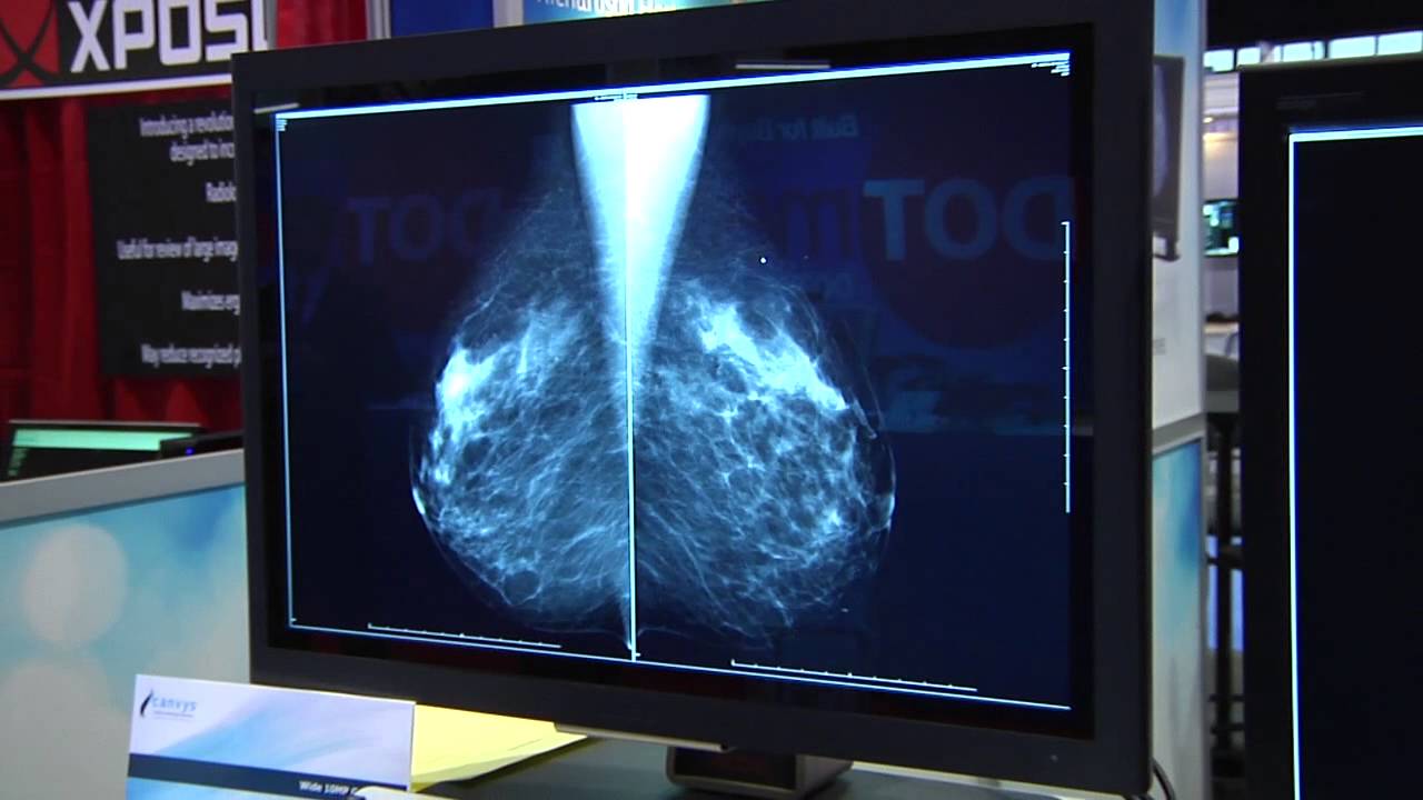 5MP and 10MP Displays for Mammography - YouTube