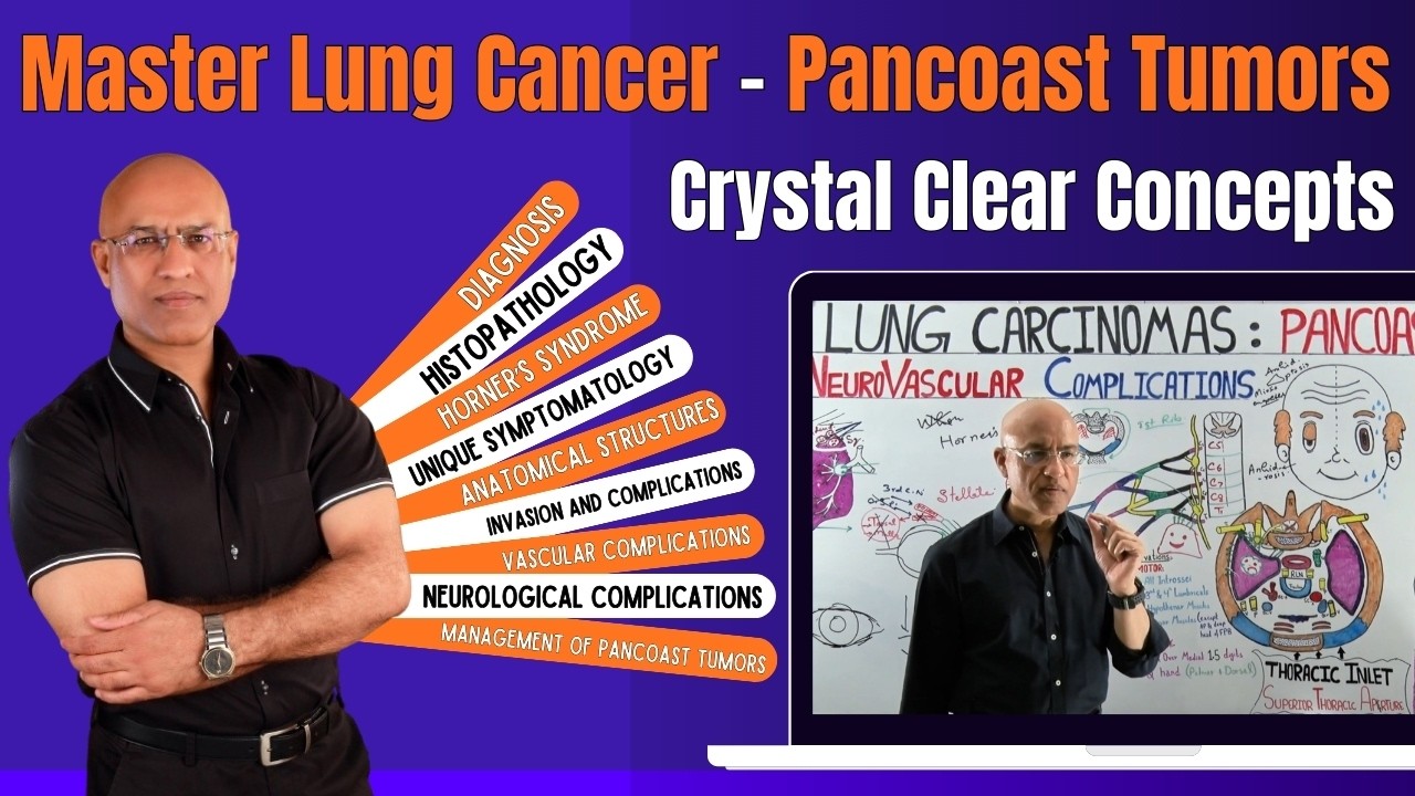 Pancoast Tumor | Lung Carcinoma Master With Clinical Significance - YouTube