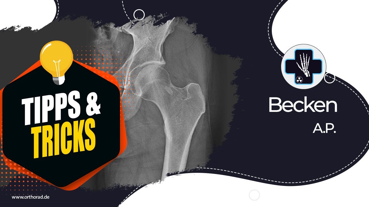 Tipps & Tricks Röntgen ☢️ Becken a.p. 💡 - YouTube