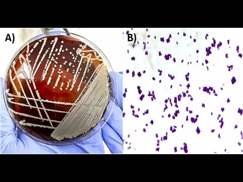 Micrococcus Lylae; Definition, Morphology, Habitat, Characteristics ...