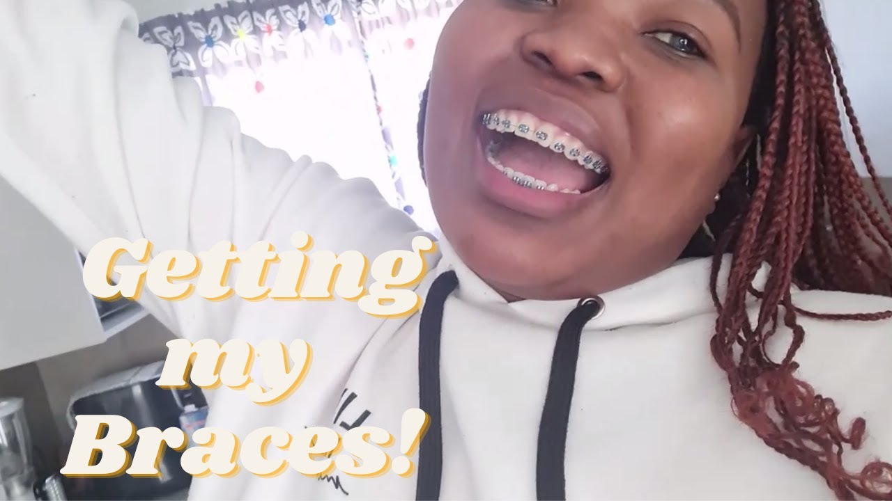 VLOG | Getting my braces on - YouTube