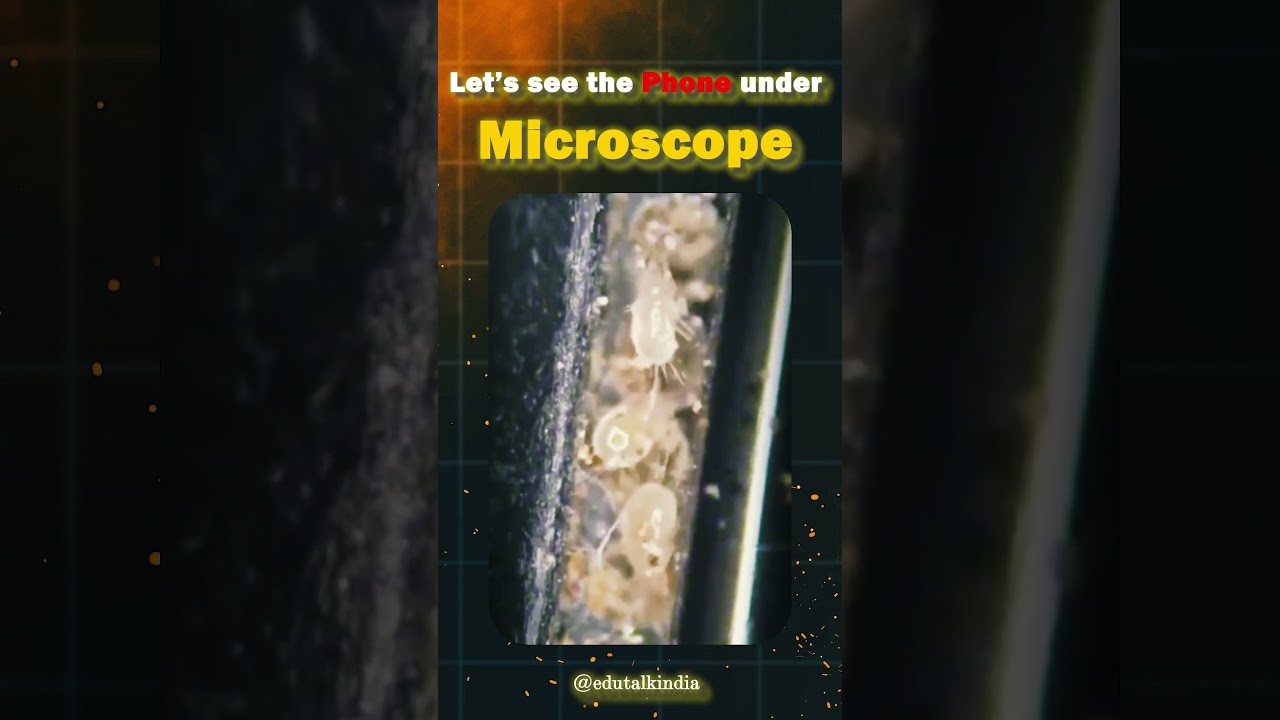 Let’s See the Prion Under a Microscope! 🔬🧫 | Mind-Blowing Discovery - Go IT