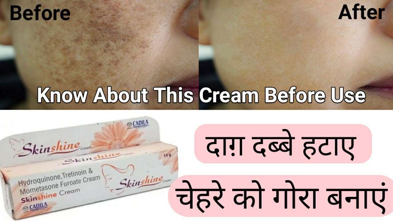 Skin Shine Cream review | Skin whitening cream | Skin Lightening cream ...