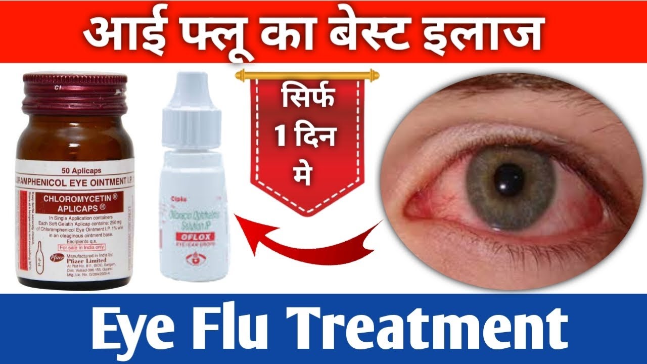 आई फ्लू का पक्का इलाज|Eye Flu Treatment|Unique Pharmacy - YouTube