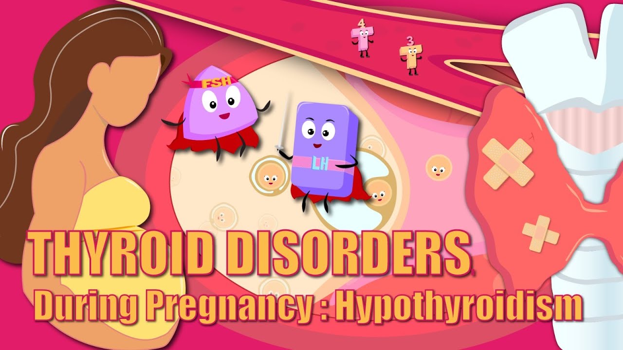 CoMICsLite Episode 9: Thyroid disorders- Underactive thyroid and ...