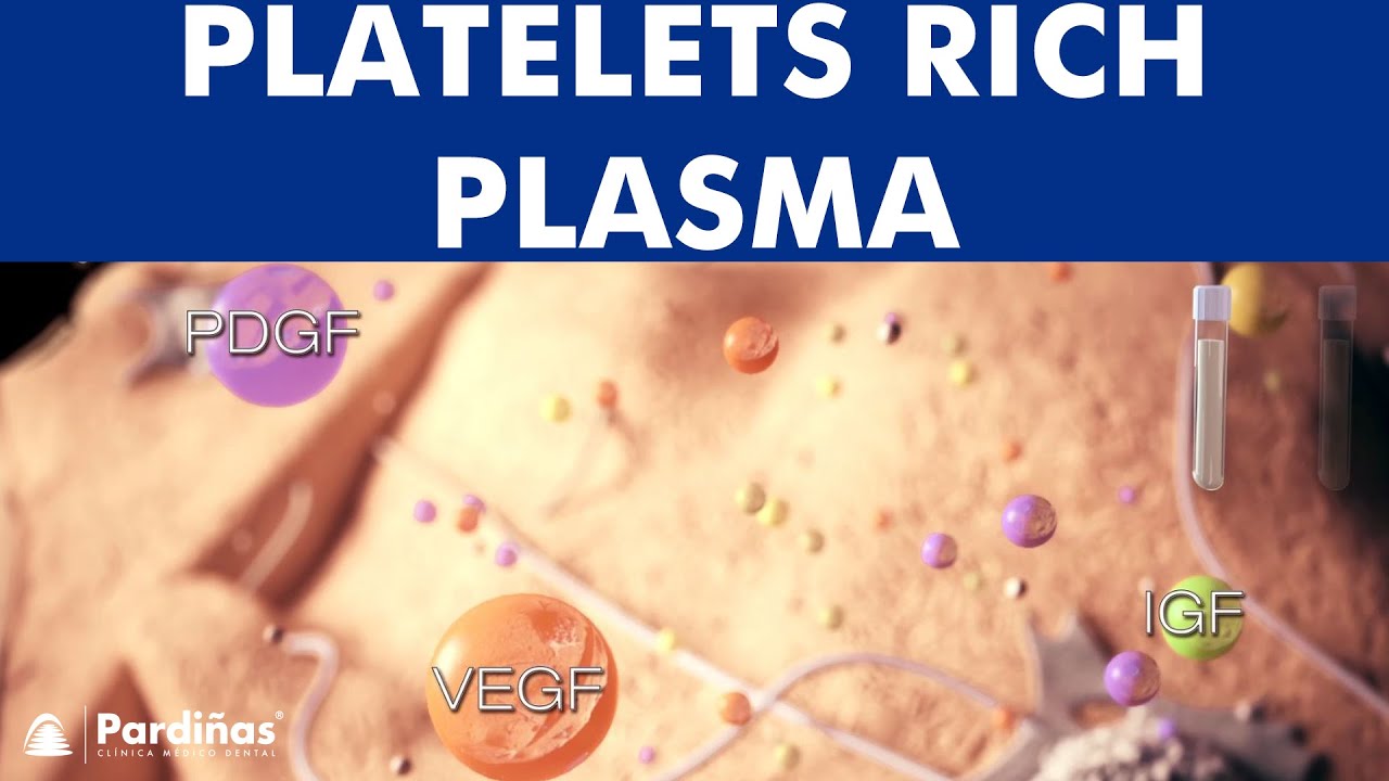 Platelet Rich Plasma - PRP - Tissue regeneration © - YouTube