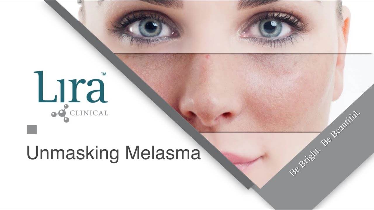 Lira Clinical Webinar - Unmasking Melasma Series Part One 08/23/21 ...
