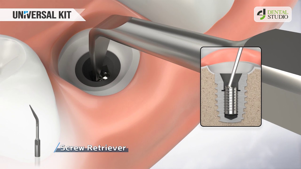 Screw Retriever - YouTube