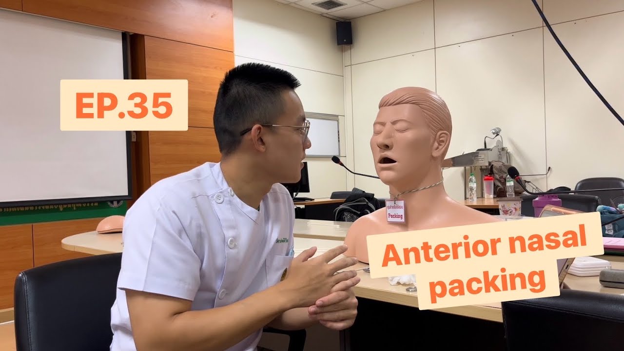 EP. 35 | Anterior nasal packing (การใช้วัสดุกดห้ามเลือดในโพรงจมูก ...