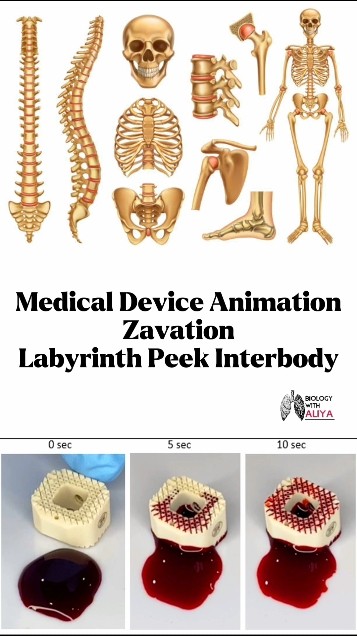 Medical Device Animation - Zavation - Labyrinth Peek Interbody #medical ...