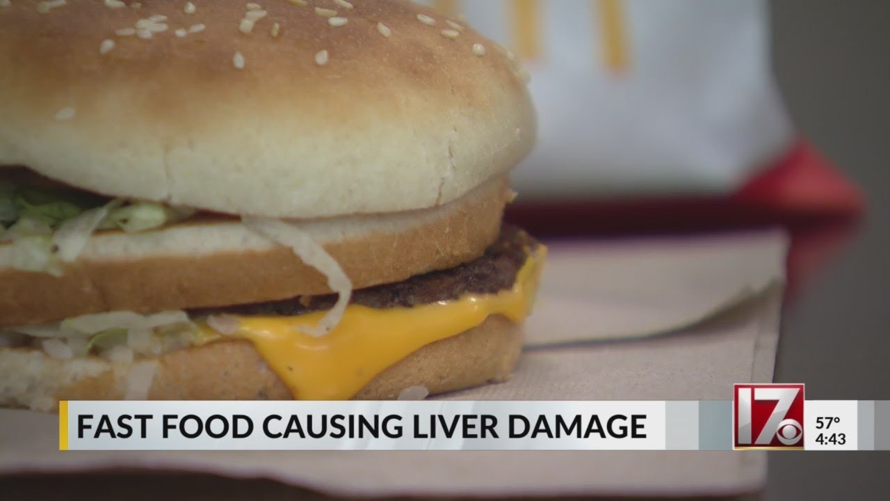 Fast food causing liver damage, doctors say - YouTube