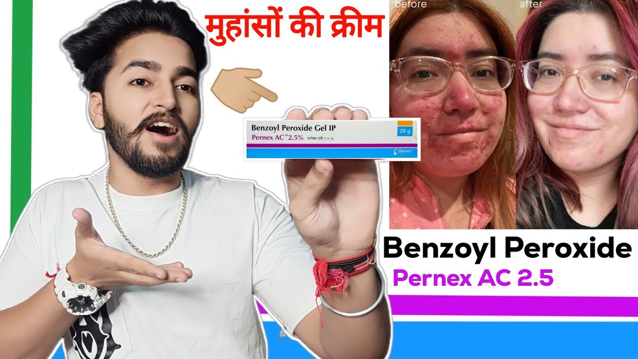 Pernex Ac Gel Review | Benzoyl Peroxide 2.5% Review - YouTube