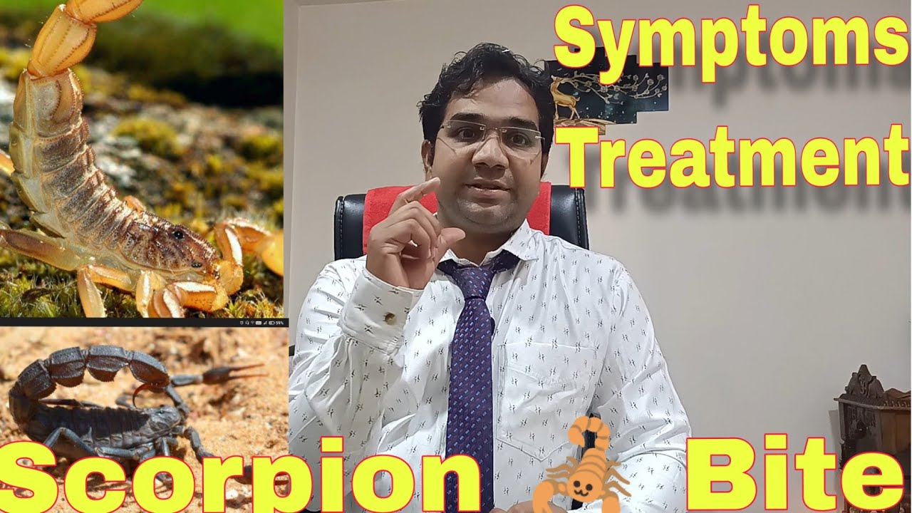 SCORPION BITE MANAGEMENT | FIRST AID | SYMPTOMS | TREATMENT - YouTube