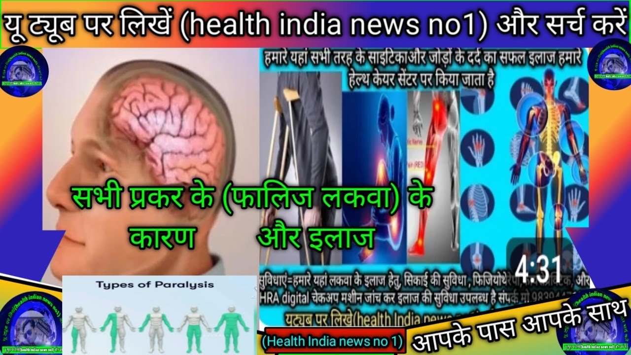 faicial paralysis lakawa, up mein lakawa ka best elaj, lakawa ki ...
