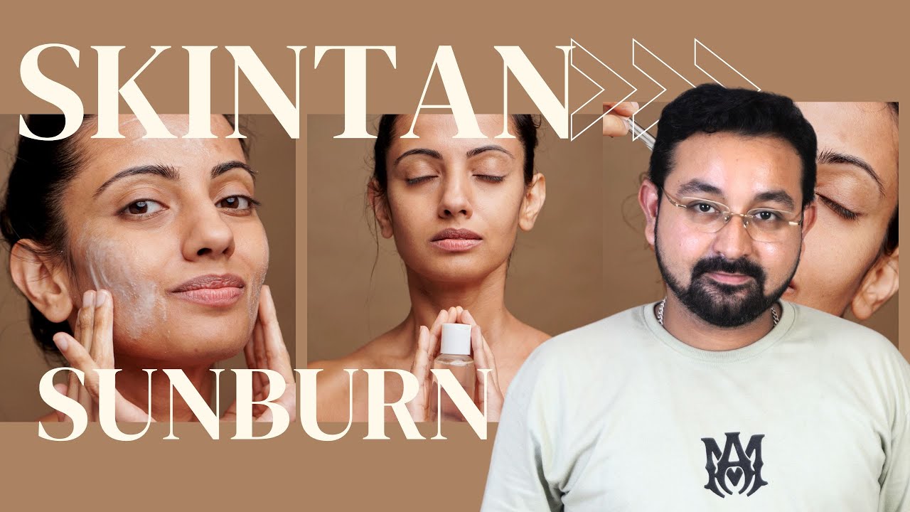 Sun Burn & Sun Tan | How to Cure | Remedies to Sun Burn or Skin Tan | Skincare Remedies - YouTube