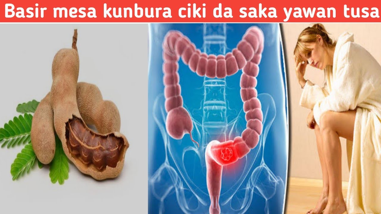 Maganin basir mesa kumburin ciki yawan tusa da rashin rike alwala - YouTube