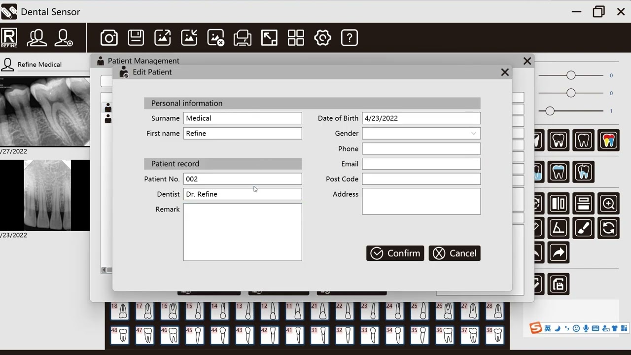 Patient Management in the Operation of Refine Dental X Ray Sensor - YouTube