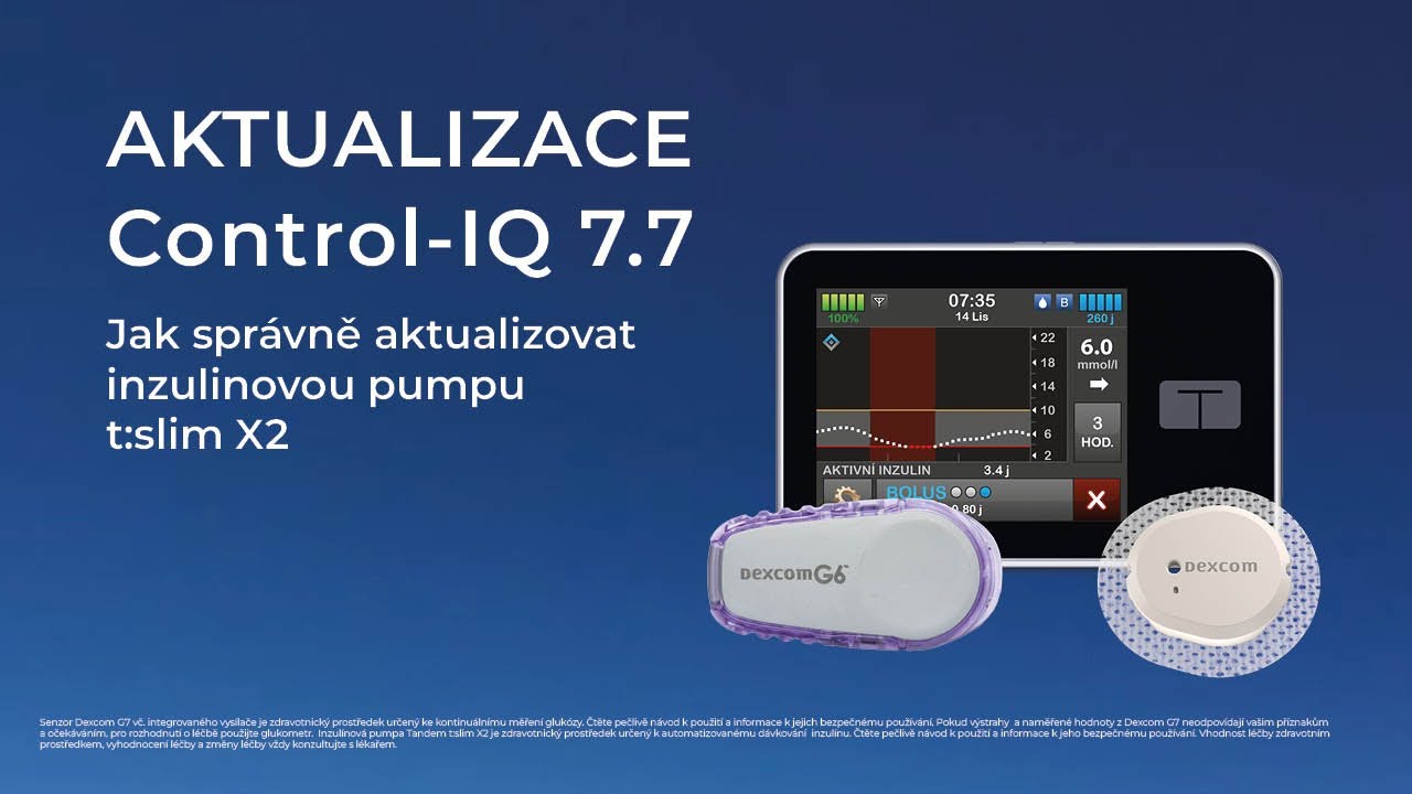 Aktualizace: Control-IQ 7.7 - YouTube