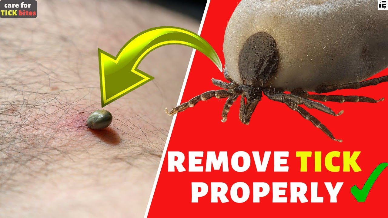 How to Remove a Tick | How to care for Tick Bite - YouTube
