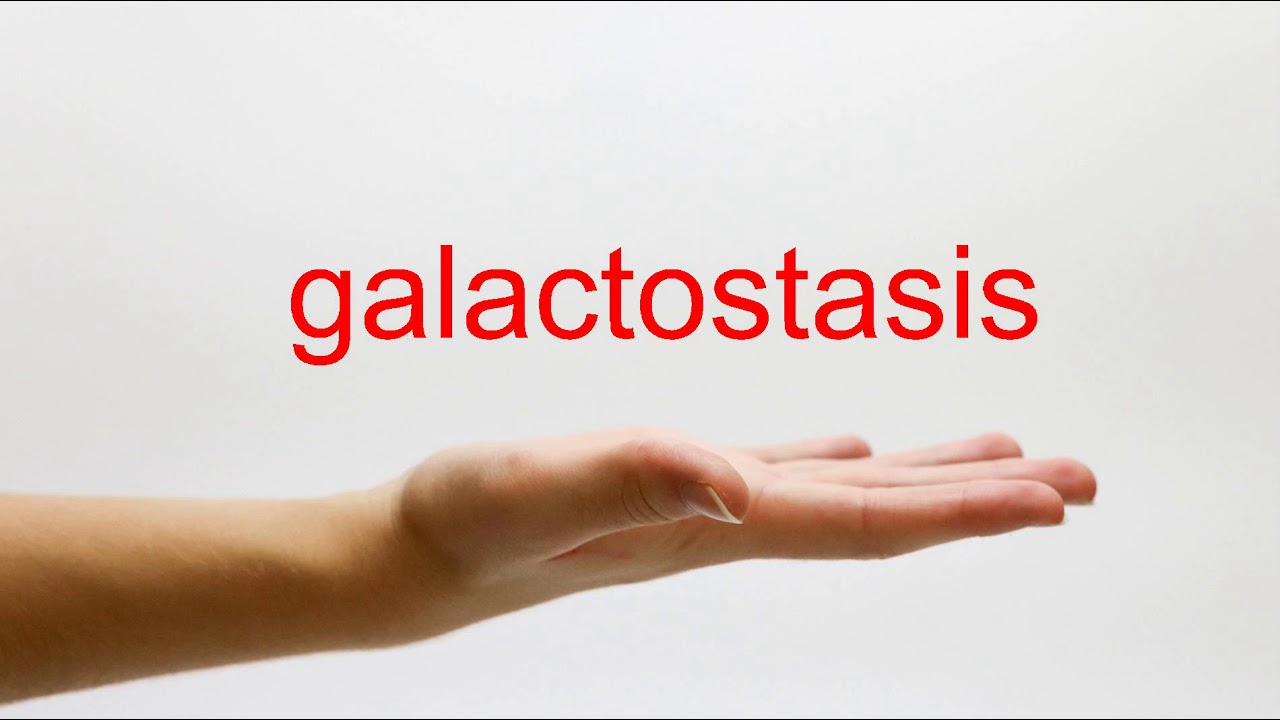 How to Pronounce galactostasis - American English - YouTube