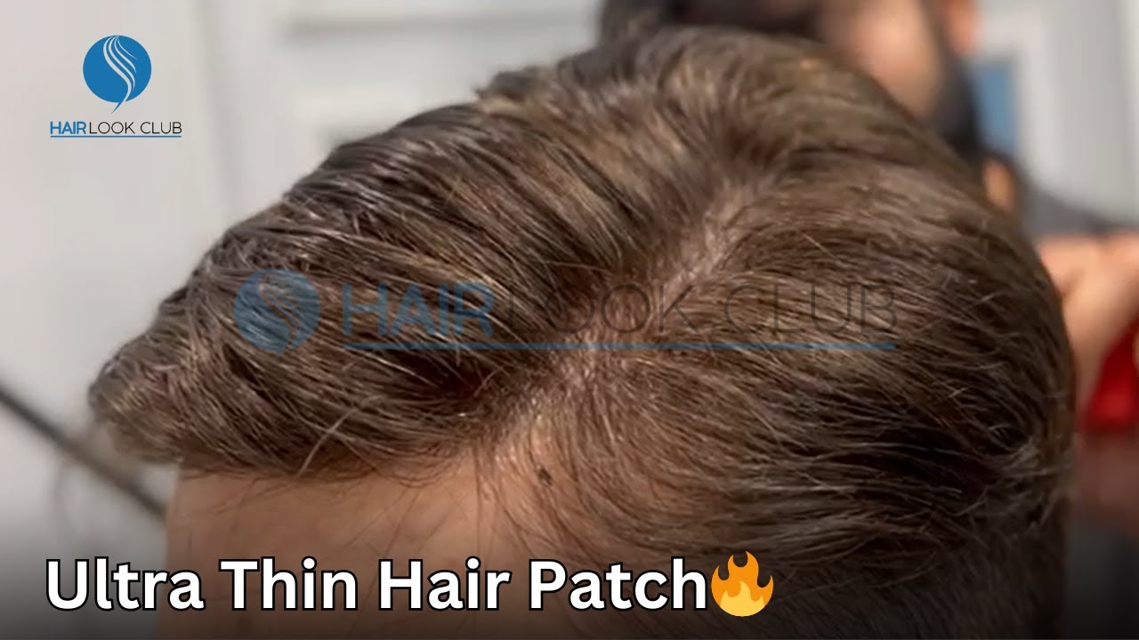 Ultra Thin Hair Patch | 100% Natural Hair Patch 🔥 | Hair Look Club ...