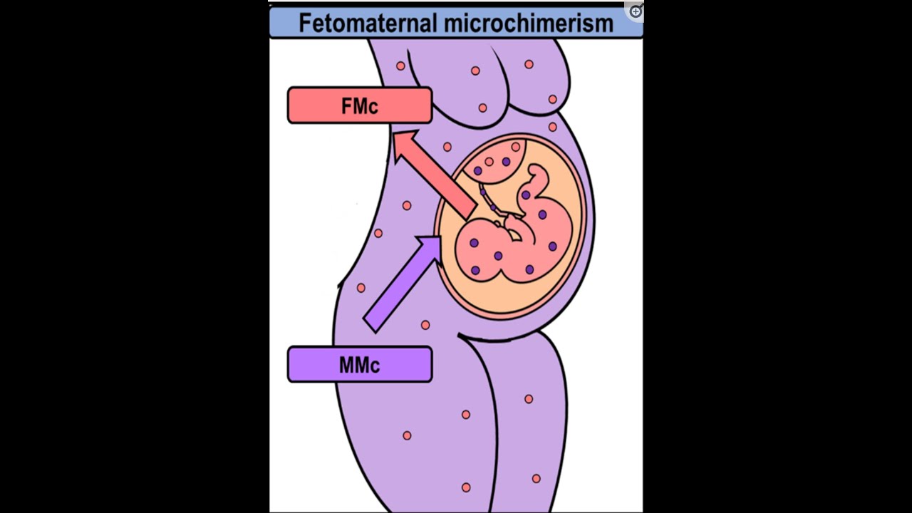 Fetal microchimerism & Mama's intuition June 2024 - YouTube