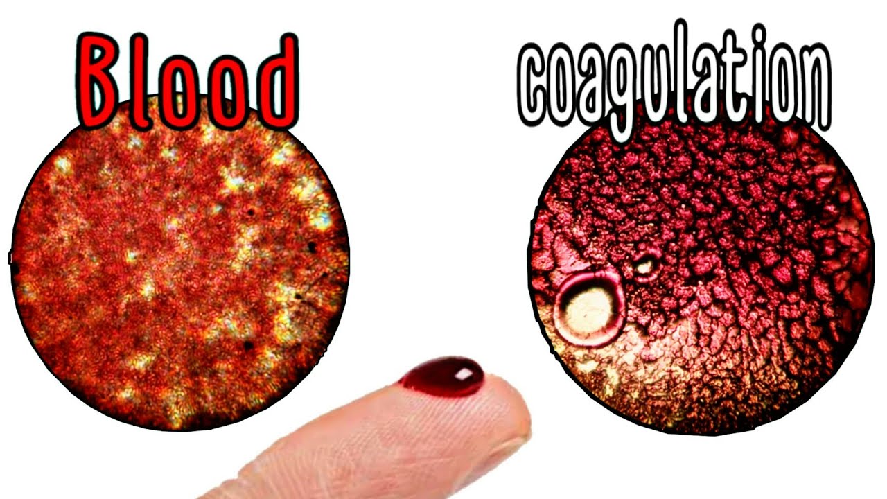 Blood clots under a microscope - YouTube