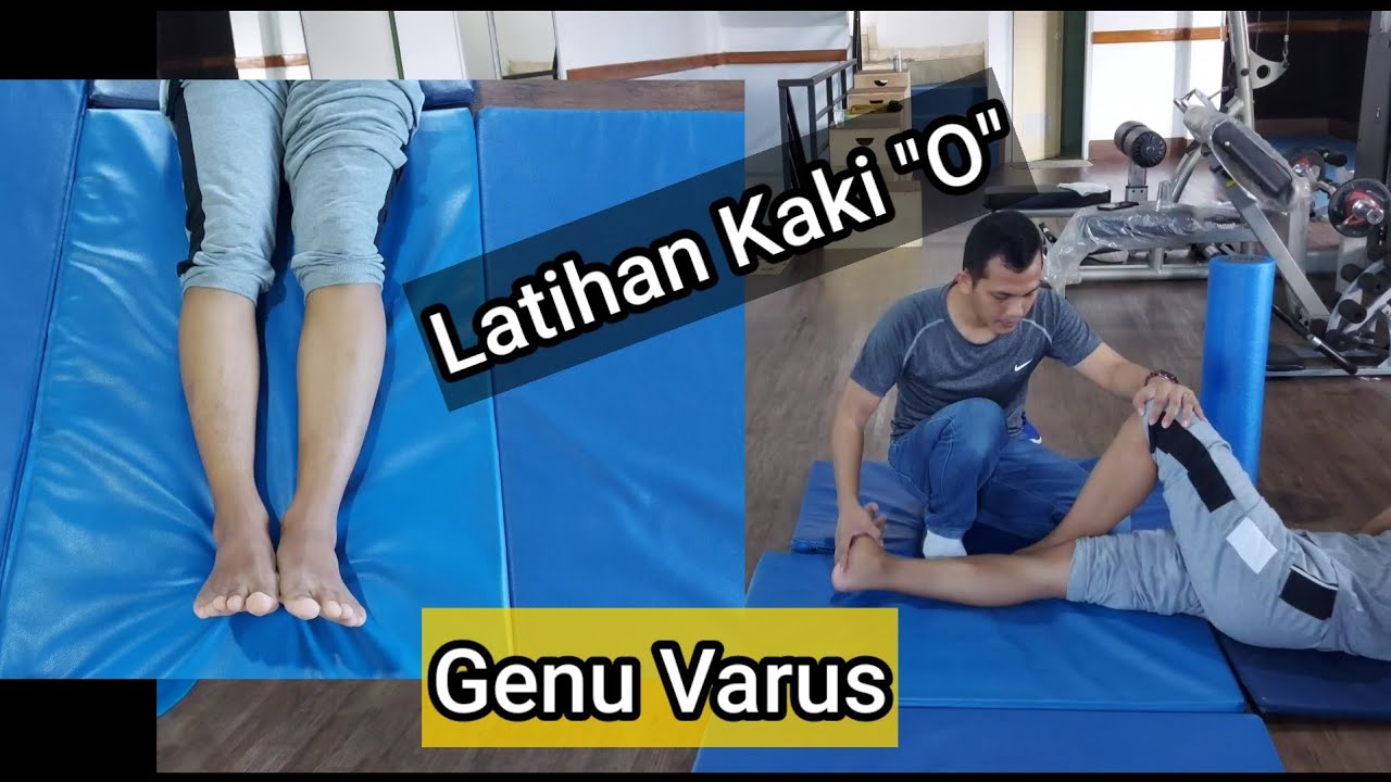 Latihan untuk kaki O ||genu varus - YouTube