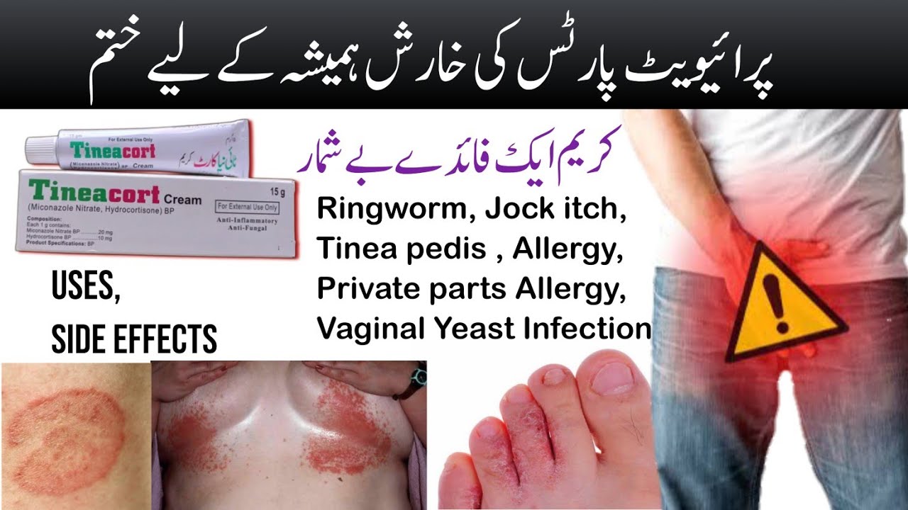 tineacort cream uses in urdu | tineacort lotion uses in urdu | fungal ...