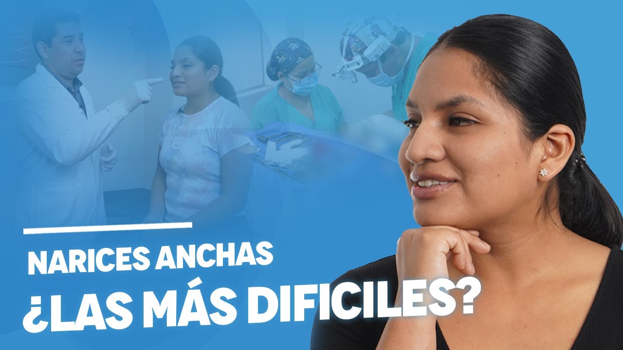 NARICES ANCHAS ¿LAS MÁS DIFÍCILES? - YouTube