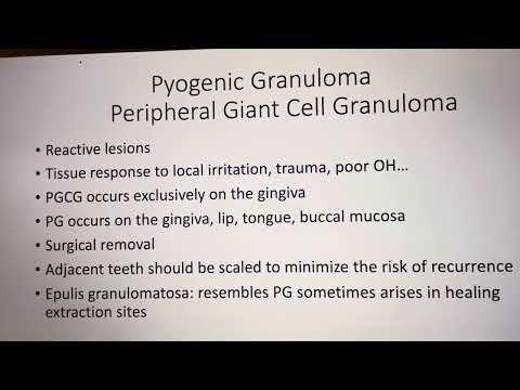 Peripheral Giant Cell Granuloma Vs Pyogenic Granuloma