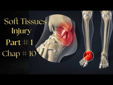 Soft tissues Injuries [ Part-1] Chapter#10 Therapeutics - YouTube