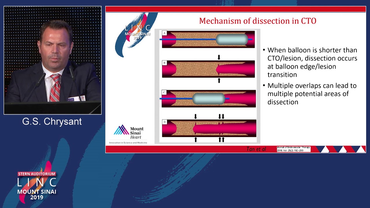 Stern D2 - How to Reduce Dissections in BTK - Dr. George Chrysant - YouTube