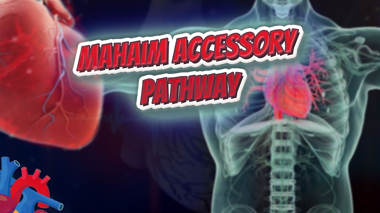 Mahaim accessory pathway - Human Heart and Cardiology ️ ️ ️🔊 - YouTube